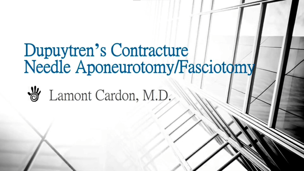Dupuytren’s Contracture Needle Aponeurotomy/Fasciotomy – Lamont J ...